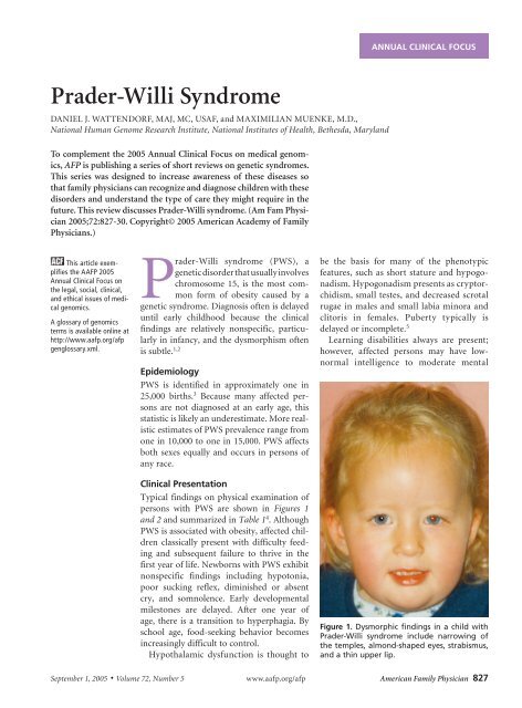 Prader-Willi Syndrome