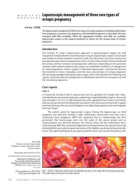 Laparoscopic management of three rare types of ectopic pregnancy