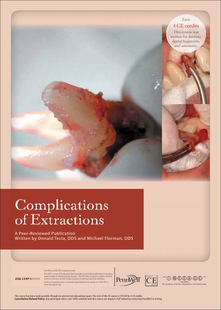Complications of Extractions - IneedCE.com