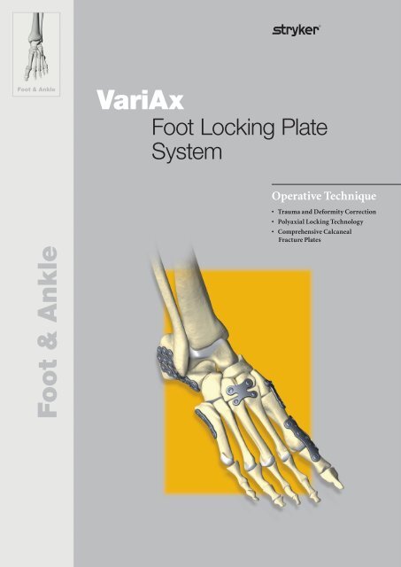 VariAx Foot Operative Technique - Stryker