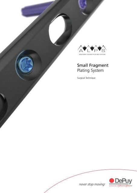 (ALPS) Small Fragment Plating System Surgical Technique - Biomet