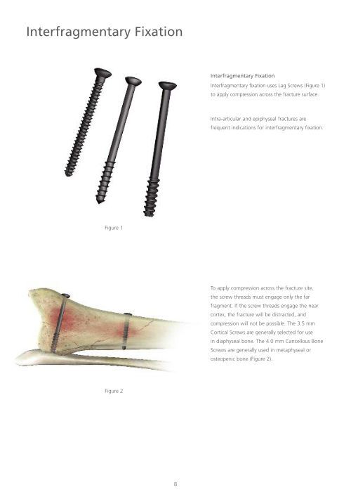 Plate and Screw Specifica