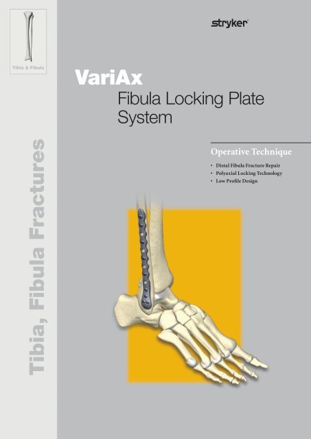 VariAx Fibula Operative Technique - Stryker