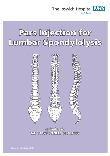 Pars Injection for Lumbar Spondylolysis - Ipswich Hospital