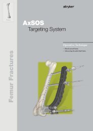 AxSOS Distal Tibia Operative Technique - Stryker