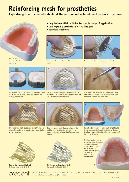 Reinforcing mesh for prosthetics - Bredent.co.uk