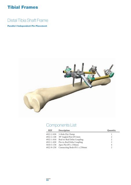 Tibial Frames Distal Tibi