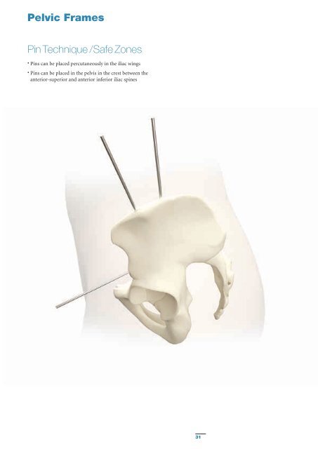 Femur Frames Femur Emerge