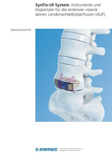 USS Fraktur MIS. Das minimalinvasive ... - Synthes