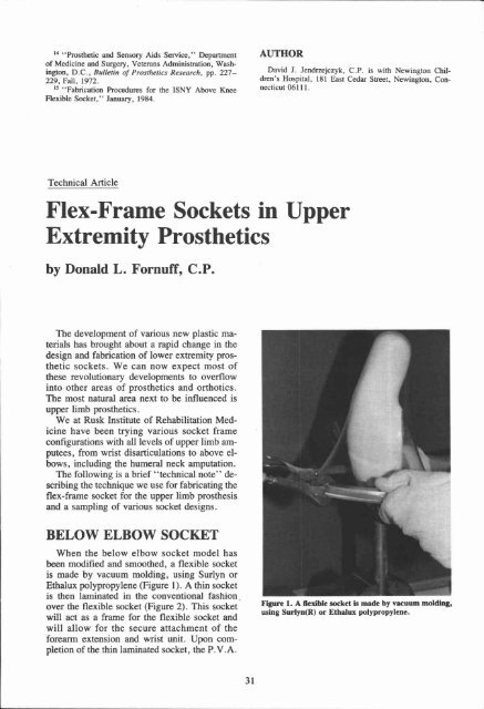 Flex-Frame Sockets in Upper Extremity Prosthetics