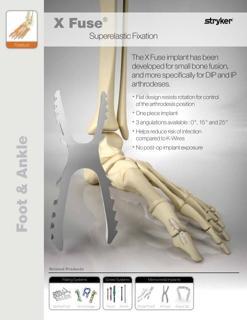 X Fuse Superelastic Fixation Sales Sheet - Stryker