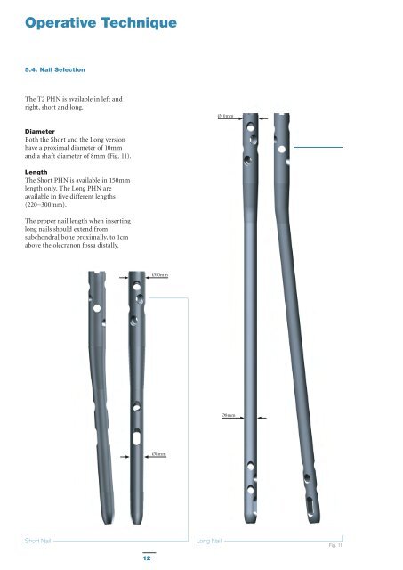 Operative Technique 5.4.