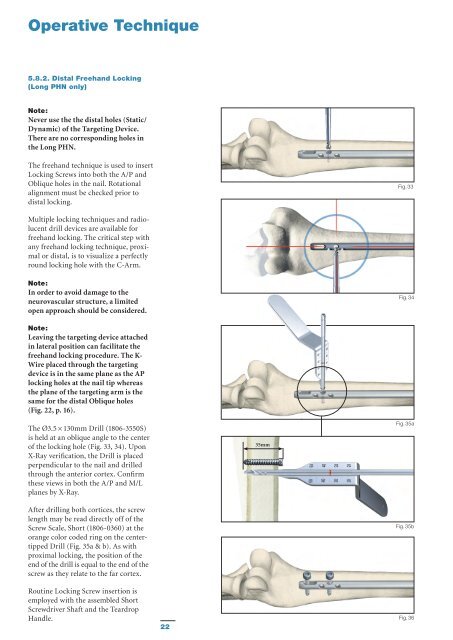 Operative Technique 5.8..