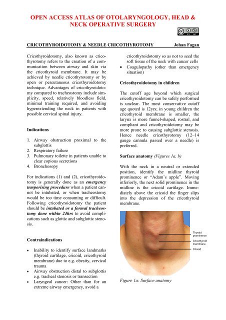 Cricothyroidotomy and needle cricothyrotomy - Vula - University of ...