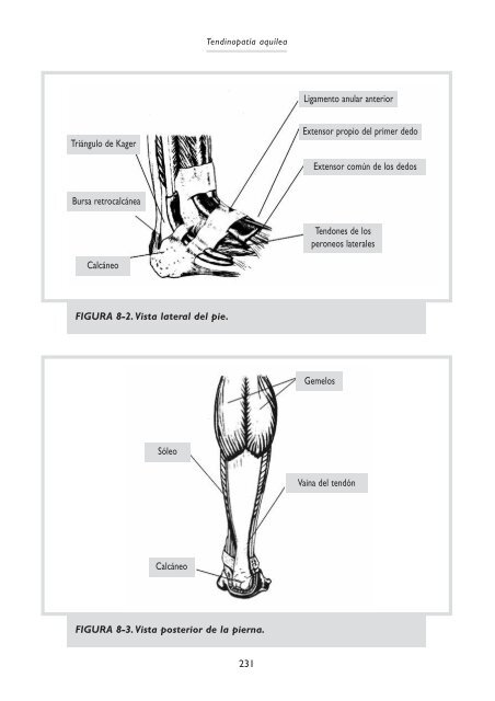 8 Tendinopatía aquílea