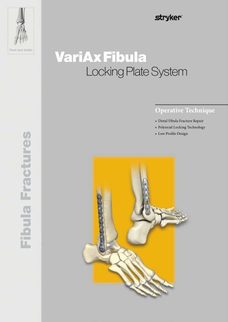 VariAx Fibula Straight Plate Operative Technique - Stryker