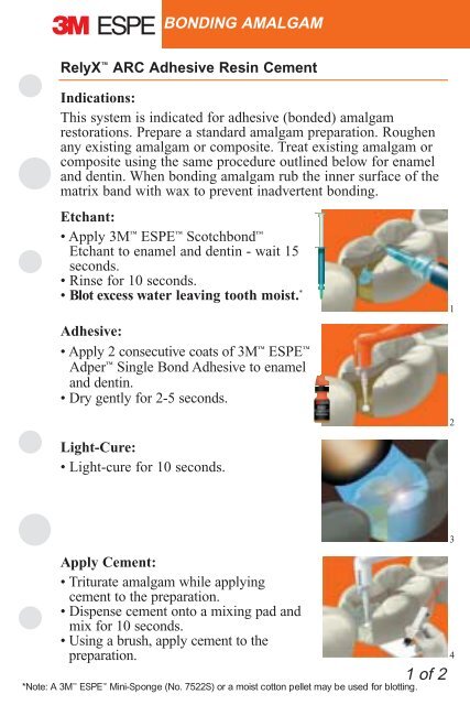 Bonding Amalgam - 3M