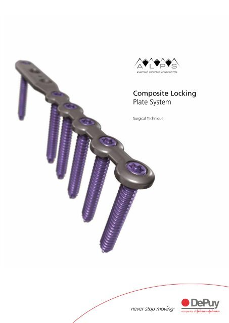 ALPS Composite Locking Plate System Surgical Technique - Biomet