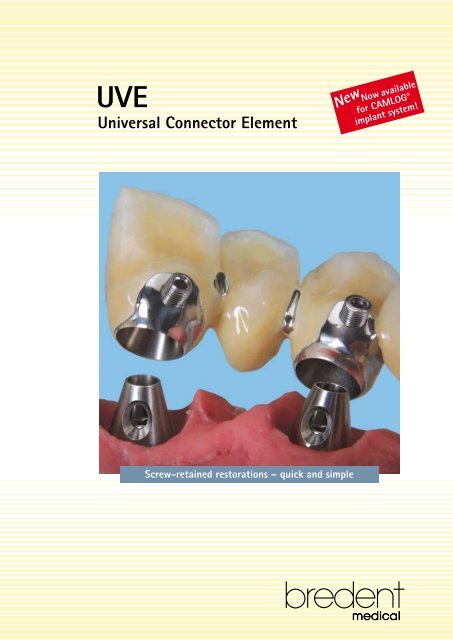 UVE Universal Connector Element - Bredent
