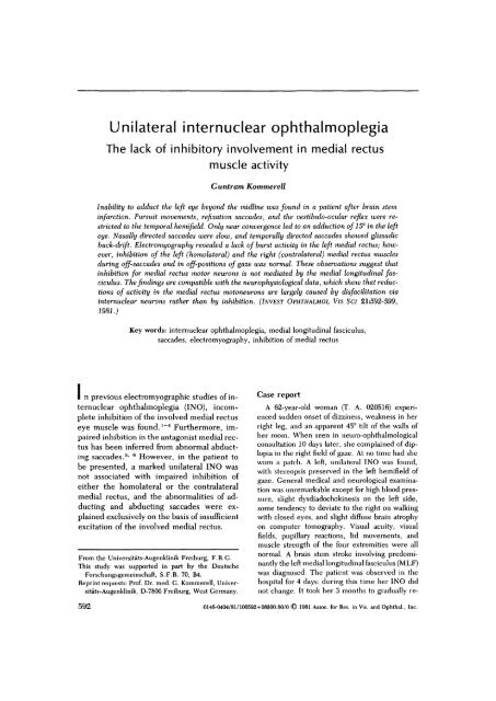 Internuclear Ophthalmoplegia Mechanism