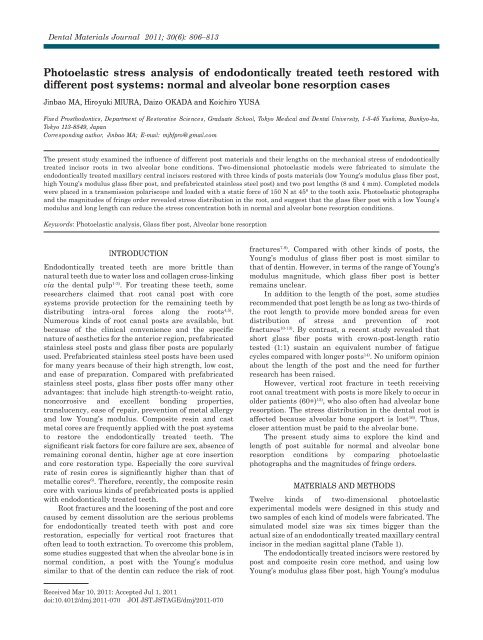 Photoelastic Stress Analysis Of Endodontically Treated Teeth Restored