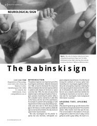 Beevor's sign NEUROLOGICAL SIGN - Practical Neurology