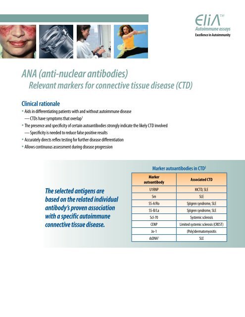 Anti Nuclear Antibody Positive Result