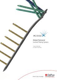 Phoenix™ Antegrade Femoral Nail System Featuring ... - Biomet