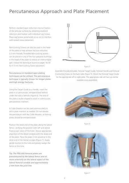 Incision Make an anterola