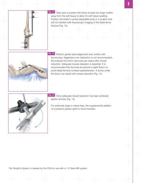 8 Fig. 9 Optimal tibial p