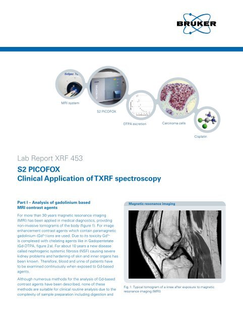 Clinical Application of TXRF spectroscopy â Lab Report ... - Bruker