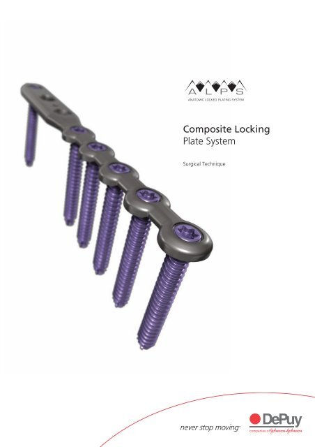 (ALPS) Composite Locking Plate System Surgical Technique - Biomet