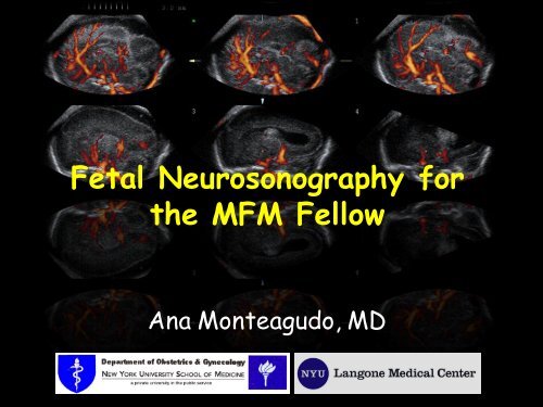 3D Fetal Neurosonography