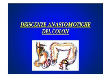 SIGMOIDOSTOMIA TERMINALE - by Hideas