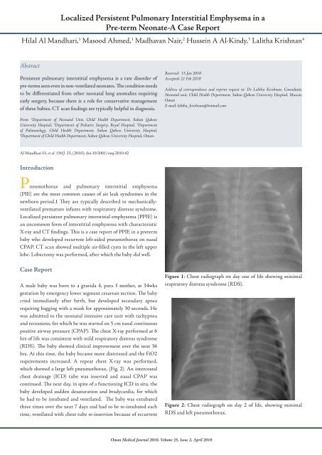 Pulmonary Interstitial Emphysema