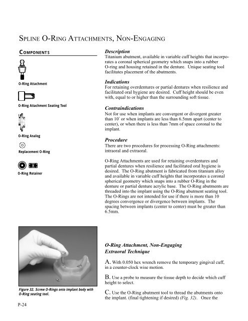 O-Ring Overdenture - Zimmer Dental