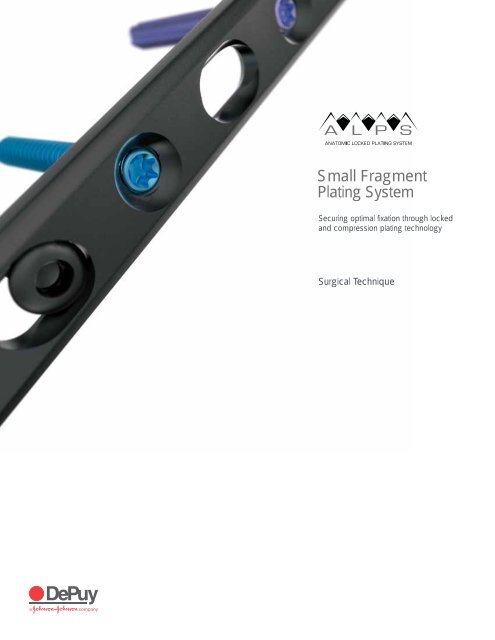 Small Fragment Plating System - Biomet