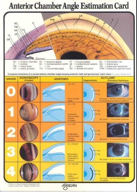 Anterior Segment