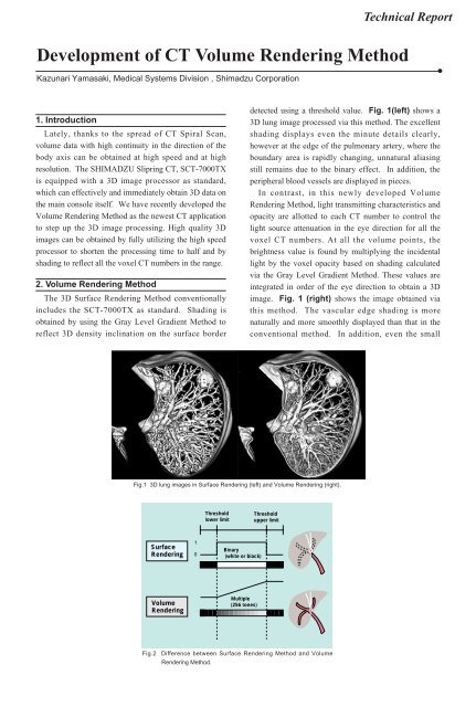 Development Of Ct Volume Rendering Method Shimadzu