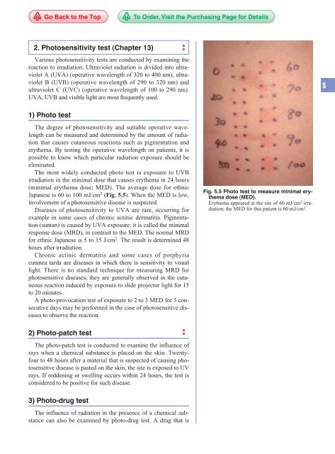 1) Photo test 2) Photo-patch test 3) Photo-drug test 2 ...