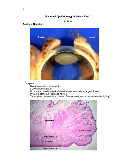 Illustrated Eye Pathology Outline - Part 2 EYELID Anatomy-Histology ...