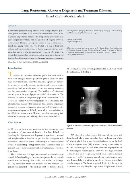 Large Retrosternal Goitre: A Diagnostic and Treatment Dilemma - OMJ