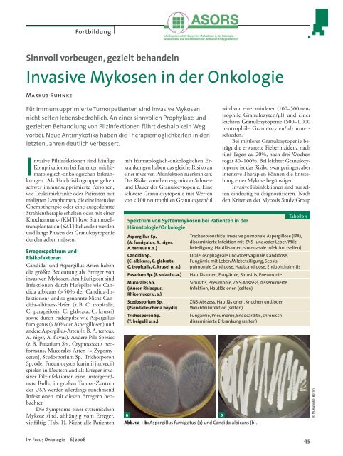 Invasive Mykosen in der Onkologie