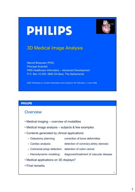 3D Medical Image Analysis