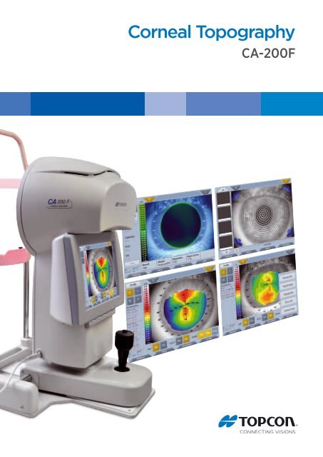 Corneal Topography - Optimed