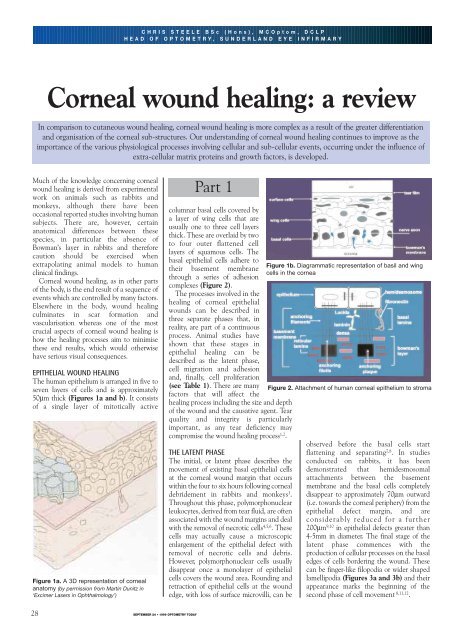 Corneal wound healing: a review - Optometry Today