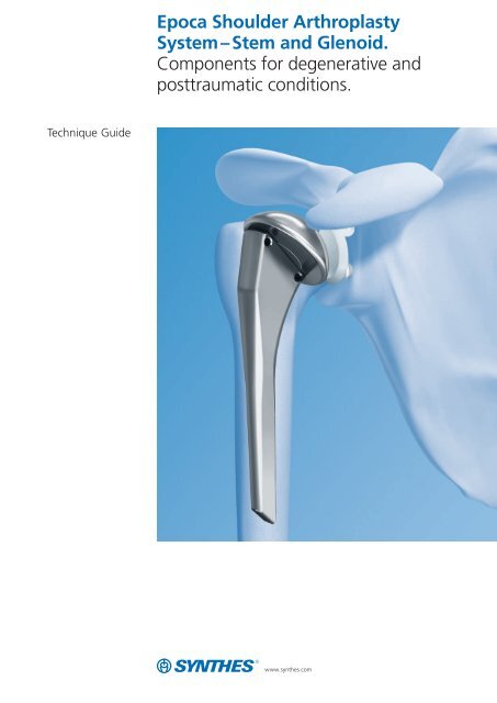 Epoca Shoulder Arthroplasty System â Stem and Glenoid ... - ORLive