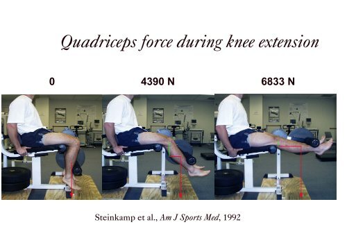 Quadriceps For