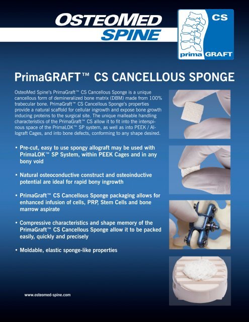 PrimaGRAFTâ ¢ CS CANCELLOUS SPONGE - OsteoMed