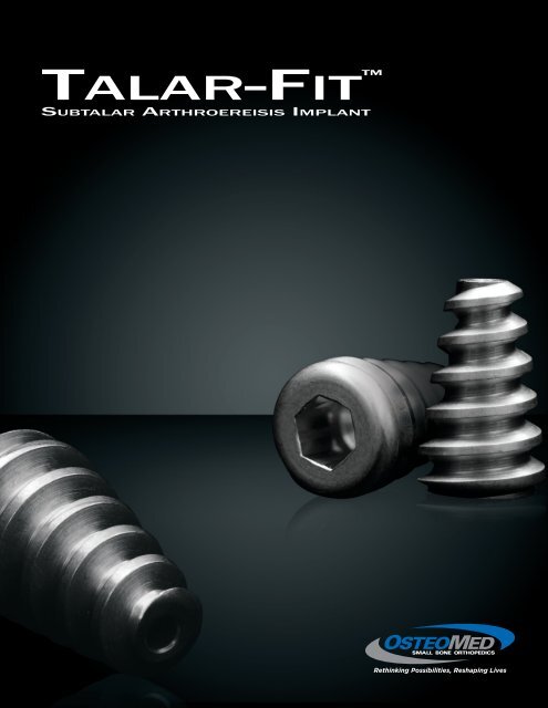 TALAR-FITâ ¢ - OsteoMed